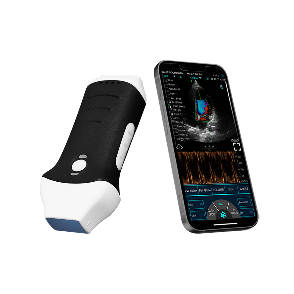 Portable Pocket Ultrasound System C10HL – BKMedStore